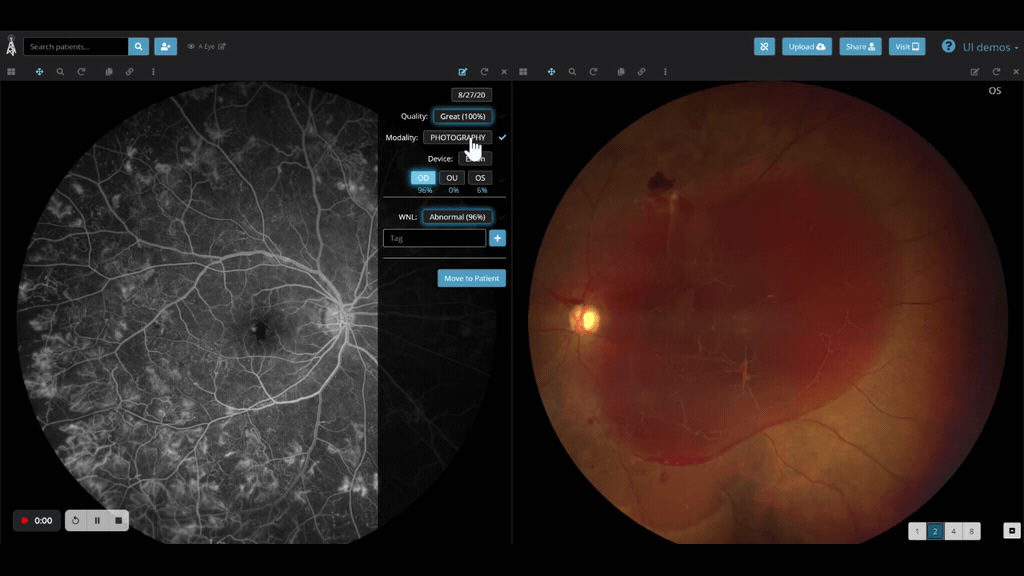 Confirming a Virtual Scribe prediction – Unified Imaging Support
